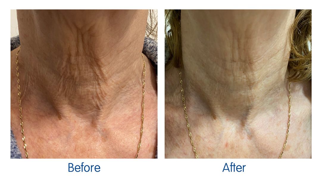 Lunchtime Facelift - Essential Rossendale Valley